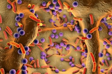 How Can You Tell If a Wound Is Infected? - Sanara MedTech