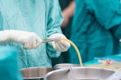 Surgical Site Drains: Benefits and Risks | Sanara MedTech