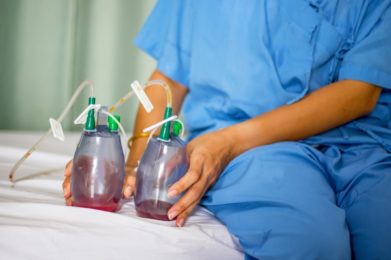 Surgical Site Drains: Benefits and Risks | Sanara MedTech